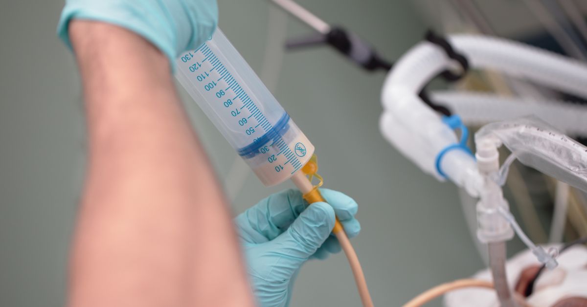 PEG Feeding: What You Need to Know