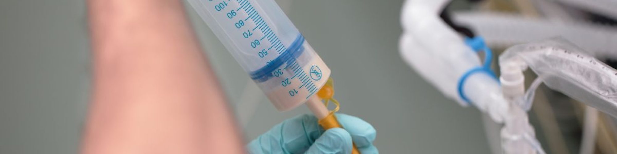 PEG Feeding: What You Need to Know